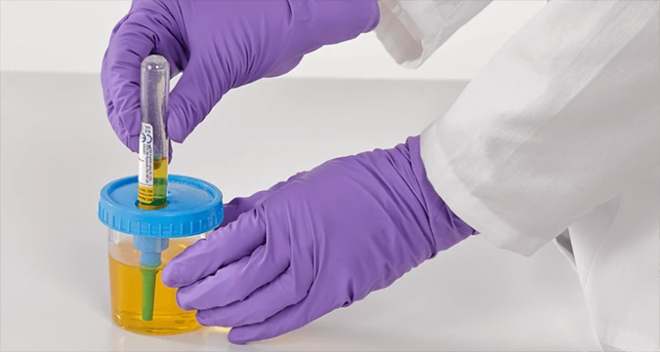 364941 • BD® Vacutainer® Urine Collection Cup, 120ml, PP, with ...